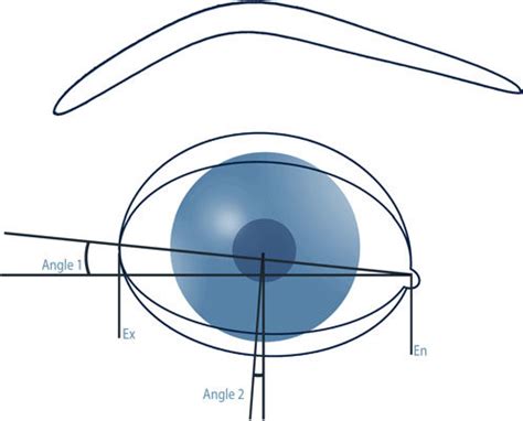 Schematic Picture Of Canthal Tilt An1 Describing The Inclination Of