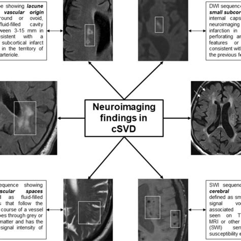 Cerebral Small Vessel Disease A Review Of The Pathophysiological