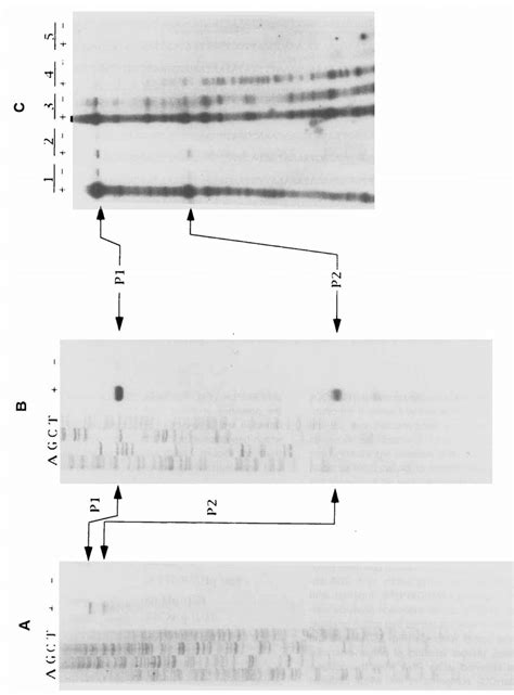 Primer Extension Analysis Total Rna Was Isolated From 5 Anthracis Download Scientific Diagram