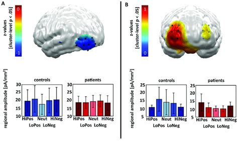 Visualization Of Differences Between Patients And Controls With Regard