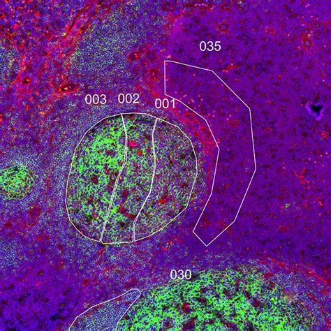 Spatial Multiomics Enabled With Geomx Dsp Nanostring