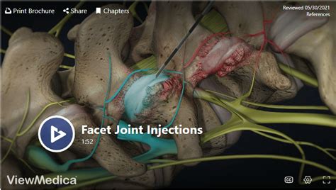 Facet Joint Injection In Knoxville Omega Pain Management