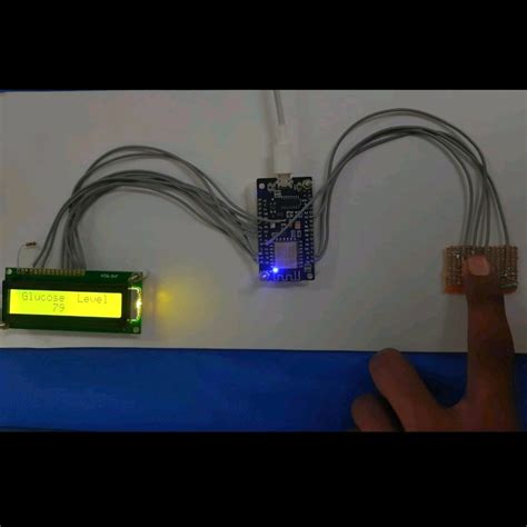 Balavignesh N On Linkedin Innovation Healthcare Diabetesmanagement Techforgood Noninvasivetech