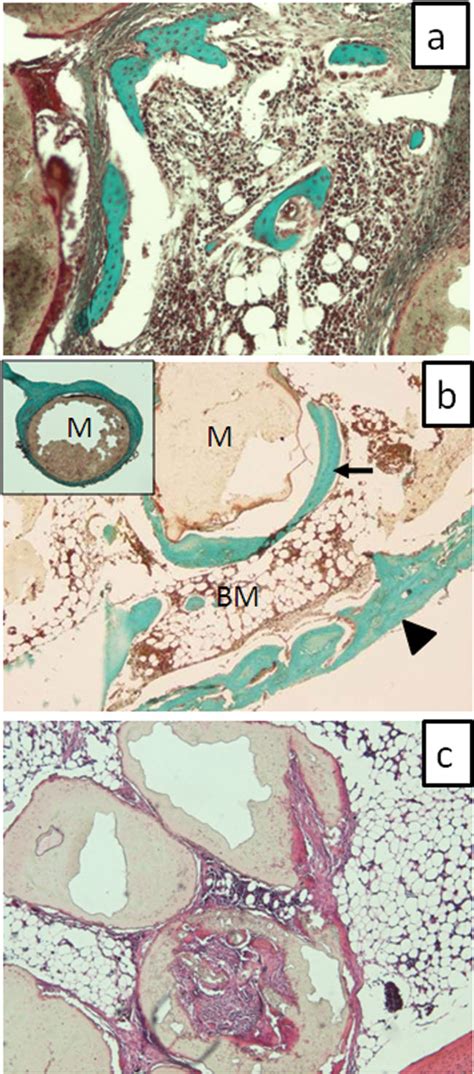 Figure 5 From In Vivo Behavior Of Si Hydroxyapatitepolycaprolactonedmb Scaffolds Fabricated By