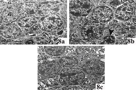 Transmission Electron Micrographs Of Cerebellar Cortex Of Pnd30 Download Scientific Diagram