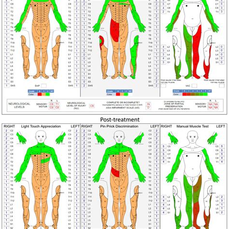Pre And Post Training Assessment Of The Participant International