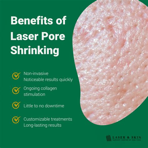 The Ultimate Guide To Laser Treatment For Shrinking Pores Laser Ny