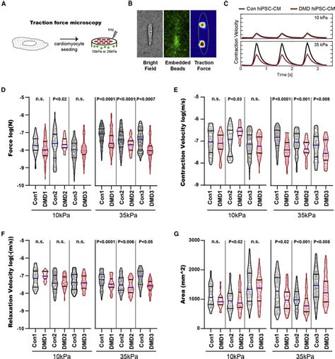 Dmd Hipsc Cms Exhibit Contractile Dysfunction Under Fibrotic