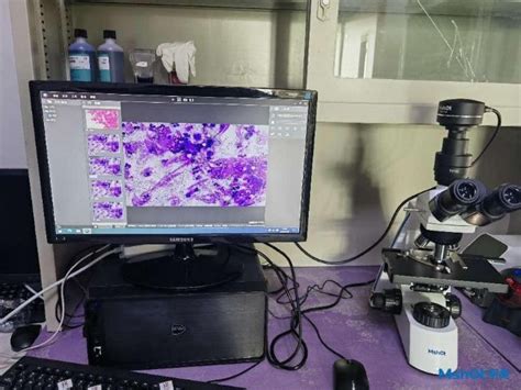 显微镜下观察到的血液细胞生物器材网