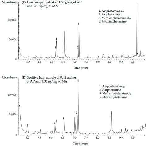 Hybrid Solid Phase Extraction For Selective Determination Of Methamphetamine And Amphetamine In