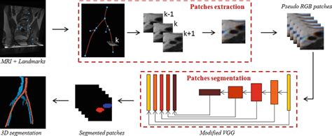 Github Aledelmo Vesselssegmentation Vascular Tree Segmentation With