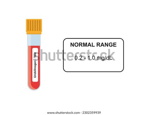 Urobilinogen Blood Test Concept Design Vector Stock Vector Royalty