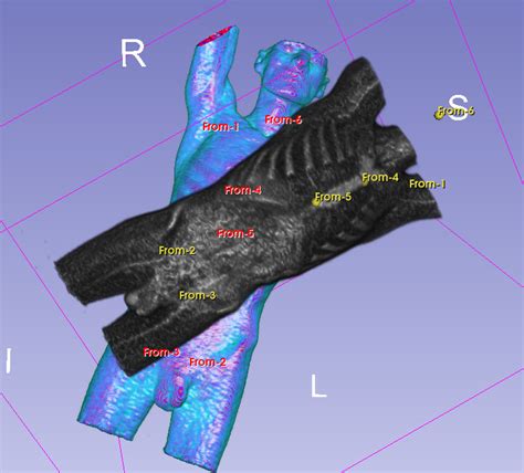 rotation of both image and landmarks issue algorithms itk