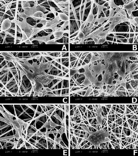 Figure 2 From Electrospun Polylactidepolyethylene Glycol Hybrid