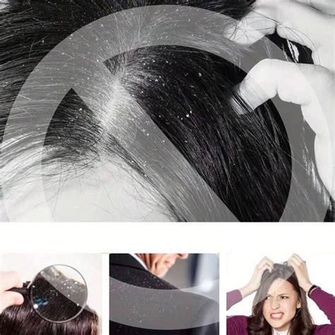 Premium Stainless Steel Comb Effective Dandruff Remover Lice Comb Scalp Massager For