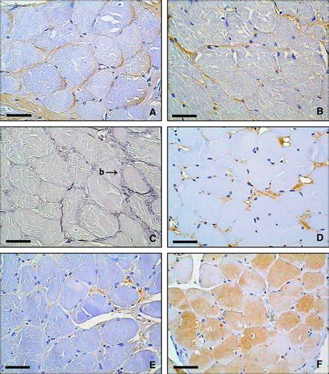 Transverse Histologic Sections Of Endomysial Extracellular Matrix
