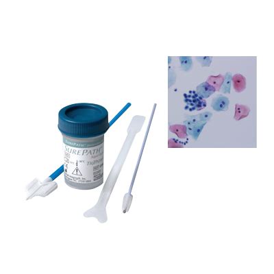 Liquid Based Cytology