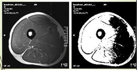 Image Processing Flashcards Quizlet Image Processing Flashcards Quizlet