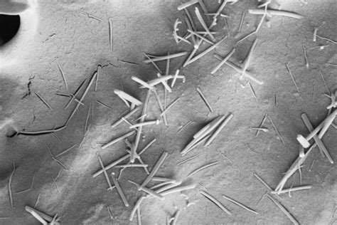 116 Questions With Answers In Mouse Embryonic Stem Cells Science Topic