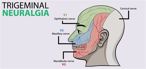 Trigeminal Nerve Faces Hidden Maestro