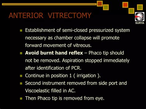 Core Anterior Vitrectomy Dr Ajay Dudani Ppt Eye And Vision