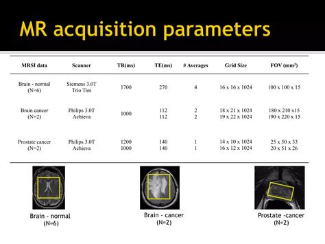 introduction to compressed sensing mri pdf