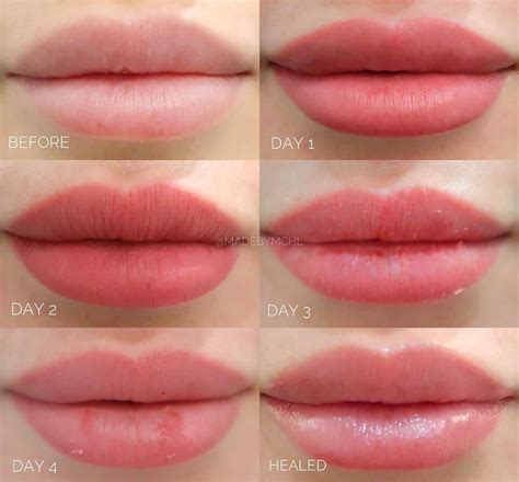Lip Blush Healing Process Day By Day Timeline And Stages