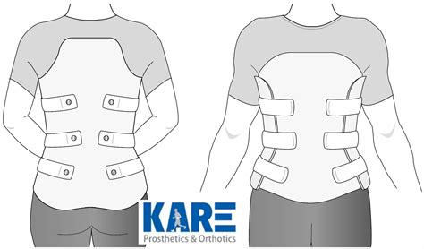 Tortoise Shell Brace