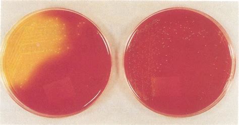 Enterococcus Faecium Vs Faecalis En Agar Sangre Pdf Phenotypic And