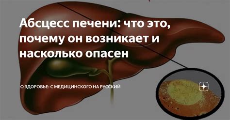 Абсцесс печени что это почему он возникает и насколько опасен О