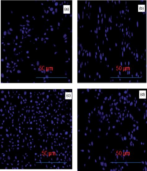 Dapi Staining Confocal Microscopy Showing Apoptosis Effect On Seed