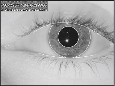 Example Of An Iris Pattern Download Scientific Diagram