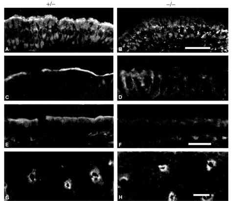 Apical Membrane Proteins Are Missing From The Cell Surface In The