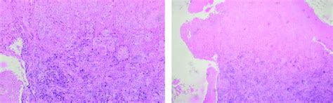 Microscopic Features Of The Lesion Download Scientific Diagram