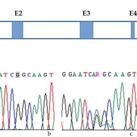 a localization of c 836a g variant in the gla gene e exon b