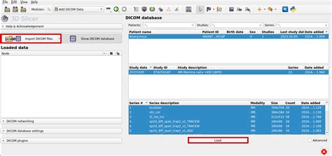 Segmentation Of 3d Mri Images With 3d Slicer Cancer Informatics