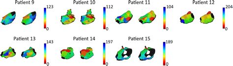 For Rotor Arrhythmia We Achieved Activation Time Accuracy Of