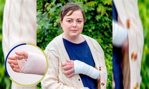 El Calvario De Una Madre Que Pide Que Le Quiten El Brazo HCH TV