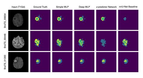 Github Risc Mibraintumor Ddpm Using Learned Visual Representations From Diffusion Models For