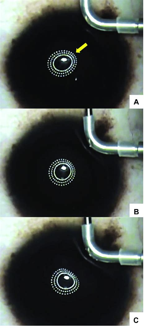 A Preoperative Surgeon View Upside Down Through Operating Download Scientific Diagram