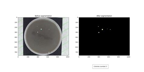 Github Keatinl1image Segmentation Segmenting Bacteria Colonies From