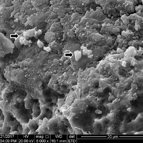 Scanning Electron Micrograph High Magnification ×6000 Of Dentin Download Scientific Diagram