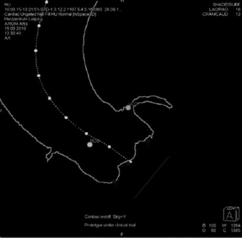 Segmentation Of Anatomical Structures And Overlay Of The Download