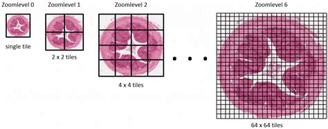 What Whole Slide Images Wsis Are Made Of Real Data Digital Pathology Blog