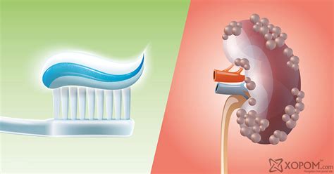 Бамбай булчирхай болон бөөрийг гэмтээж хорт хавдар үүсгэх сөрөг нөлөөтэй дараах 10 найрлагыг