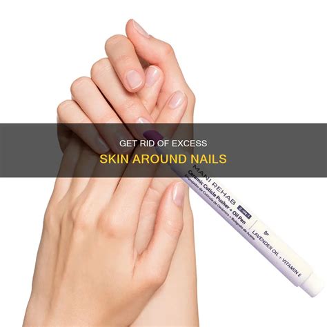 Get Rid Of Excess Skin Around Nails Nailicy