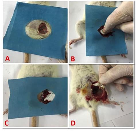 Femoral Artery In The Left Inguinal Region A Algan Hemostatic Agent