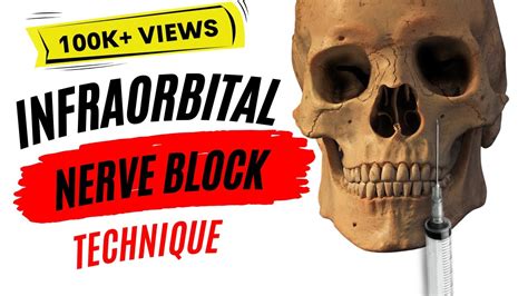 Infraorbital Nerve Function