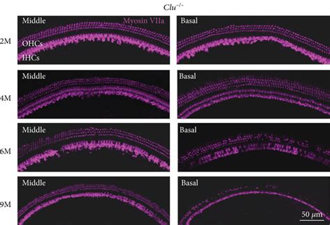 Assessment Of Age Related Morphology Of Hair Cells And Supporting Download Scientific Diagram