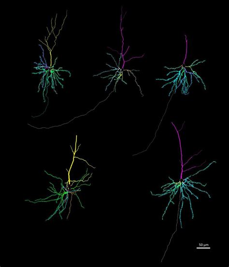 Examples Of Reconstructions Of Pyramidal Neurons In The Anterior Download Scientific Diagram